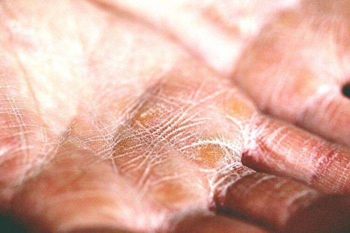 Interessant | 5 huidtypes - Wat is mijn huidtype? ⋆ Liefsmarielle.nl.nl